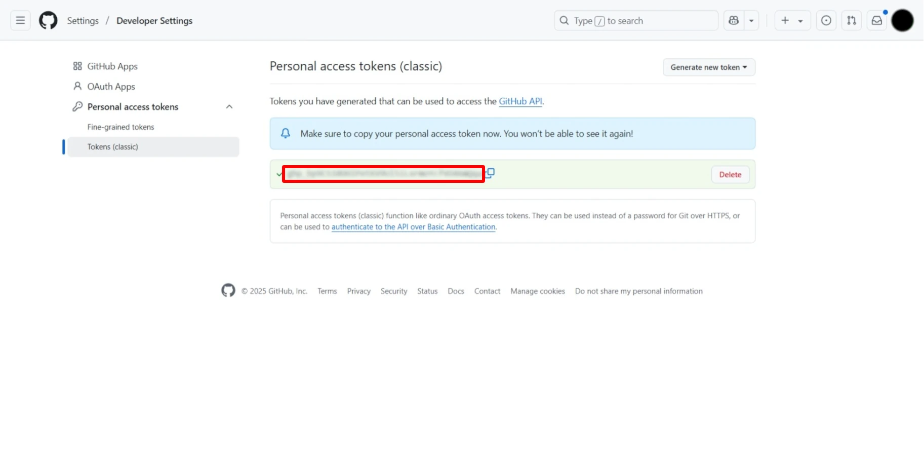 セットアップ手順